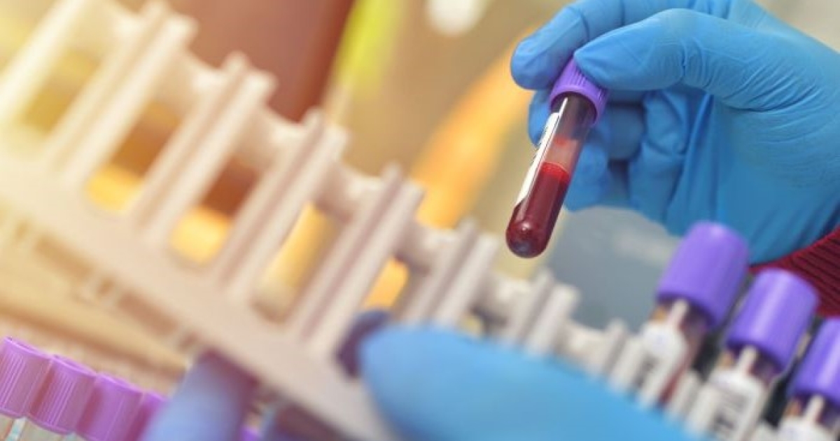 Can you trust that lab-developed test? Here’s what to know | Center for ...